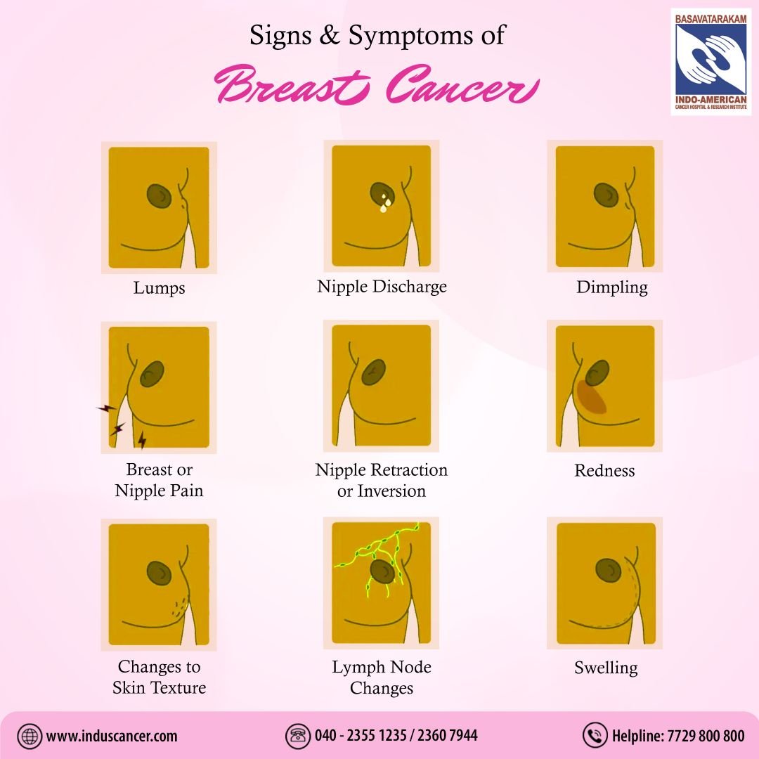 Understanding Breast Cancer A Comprehensive Guide Induscancer